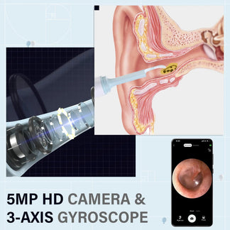 Visual Smart Ear Cleaner – WonderCrate